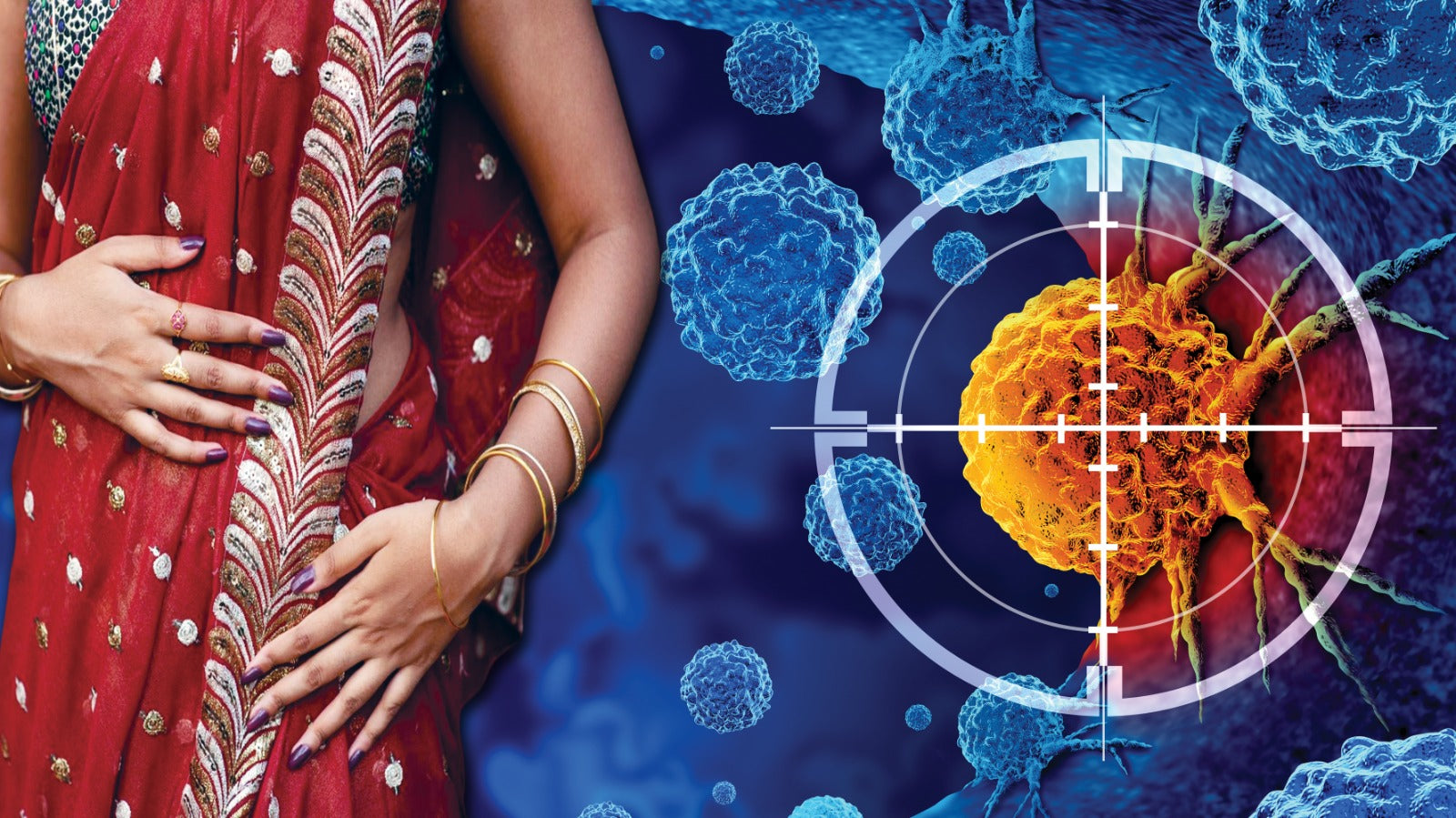 Understanding Saree and Petticoat-Related Cancer: Causes, Symptoms, an ...